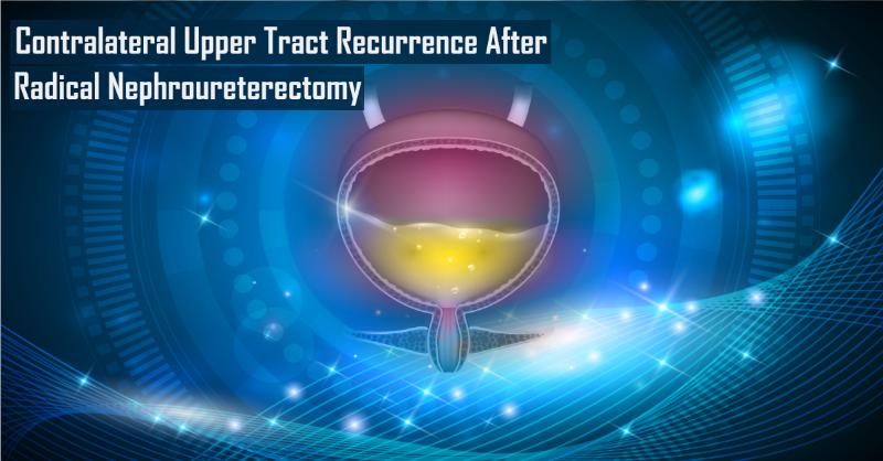 Contralateral Upper Tract Recurrence after Radical Nephroureterectomy ...