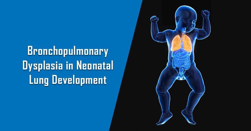 Diagnosis of Bronchopulmonary Dysplasia During Neonatal Lung ...