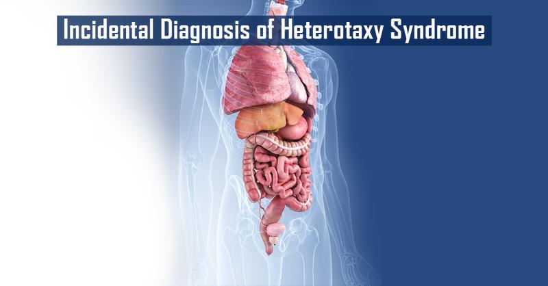 Incidental Diagnosis of Heterotaxy Syndrome | MedSynapse
