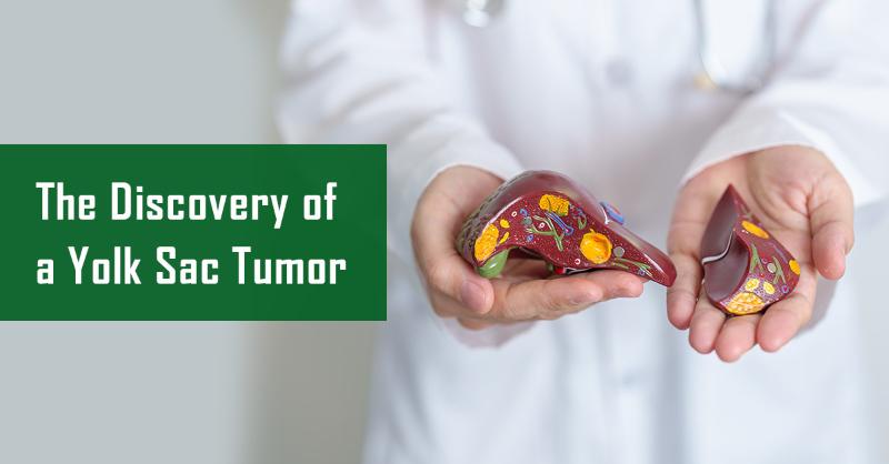 Painless Jaundice Unveils Yolk Sac Tumor | MedSynapse