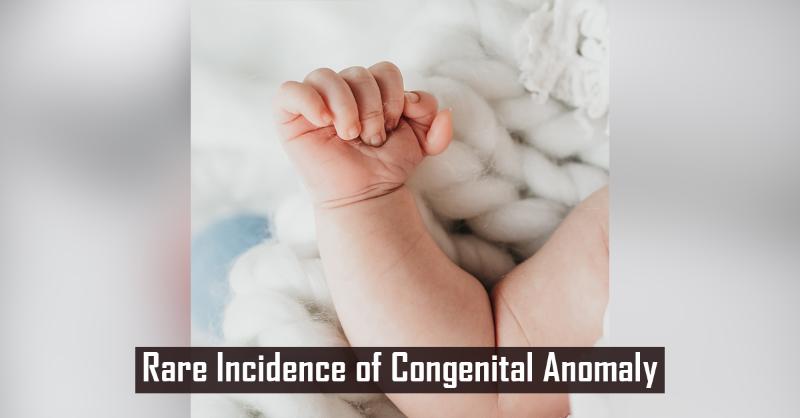 Congenital Anomaly Seen in a New-born Female | MedSynapse