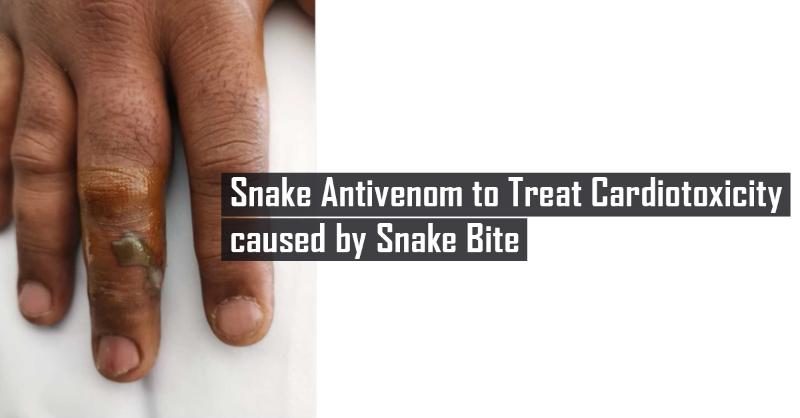 Snake Antivenom to Treat Cardiotoxicity caused by Snake Bite | MedSynapse