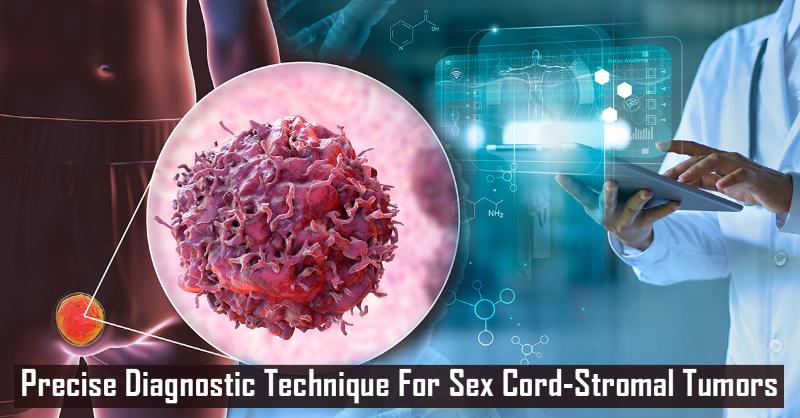 Newer Ways of Diagnosing Testicular Sex Cord-Stromal Tumors | MedSynapse