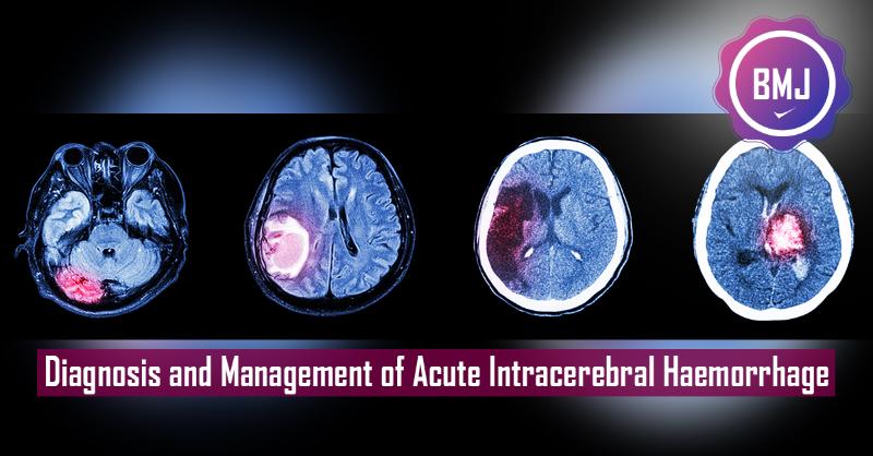 Acute Intracerebral Haemorrhage: Diagnosis and Management | MedSynapse
