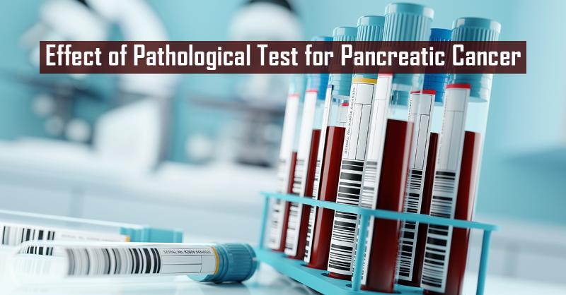 Pathological Test for Pancreatic Cancer | MedSynapse