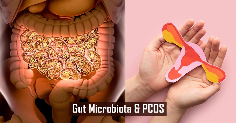 Role of Gut Microbiota in Polycystic Ovary Syndrome | MedSynapse