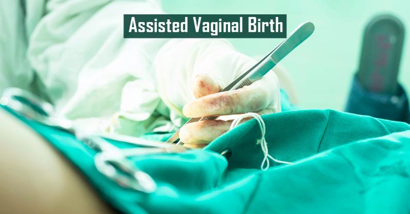 Guidelines on Assisted Vaginal Birth | MedSynapse