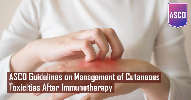 ASCO Guidelines for Management of Cutaneous Toxicities Following ...