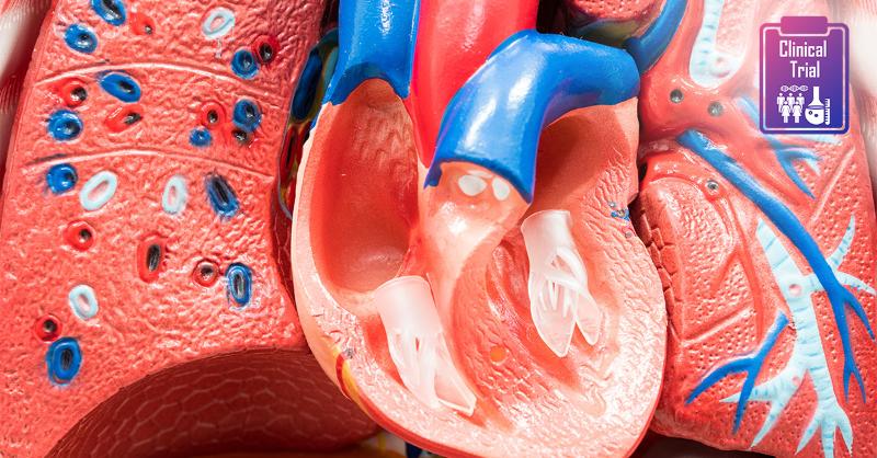 Left Atrial Function On Pulmonary Arterial Pressure In Acute Myocardial ...