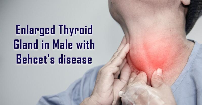 Diagnosis of a Patient with Enlarged Thyroid Gland | MedSynapse