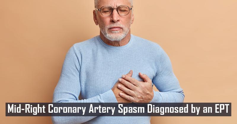Mid-Right Coronary Artery Spasm Diagnosed by an Ergometrine Provocation ...
