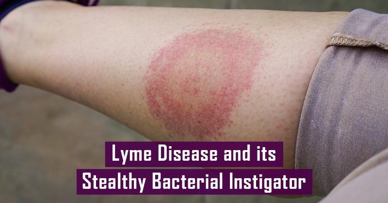Unveiling Lyme: Understanding the Disease and Its Impact | MedSynapse