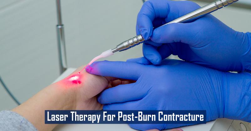 Low-Level Laser Therapy in Post-Burn Contracture | MedSynapse