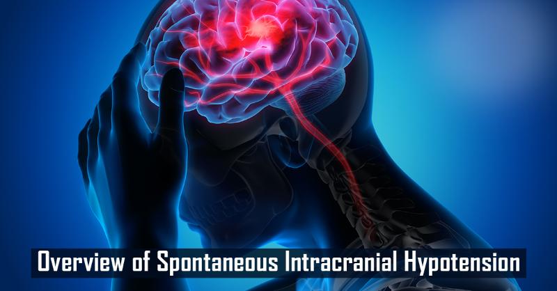 Spontaneous Intracranial Hypotension | MedSynapse