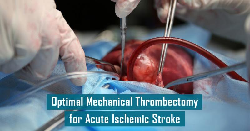 Which Mechanical Thrombectomy Strategy Is Best for Acute Ischemic ...