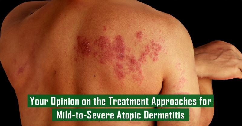 Recommendation on the Choice of Drugs for Treating Moderate-to-Severe ...