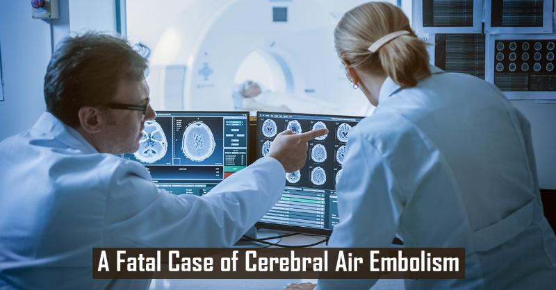 Pressurized Peripheral Bolus Leading to Arterial & Venous Cerebral Air ...