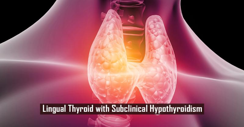 Lingual Thyroid with Subclinical Hypothyroidism in a Young Female ...