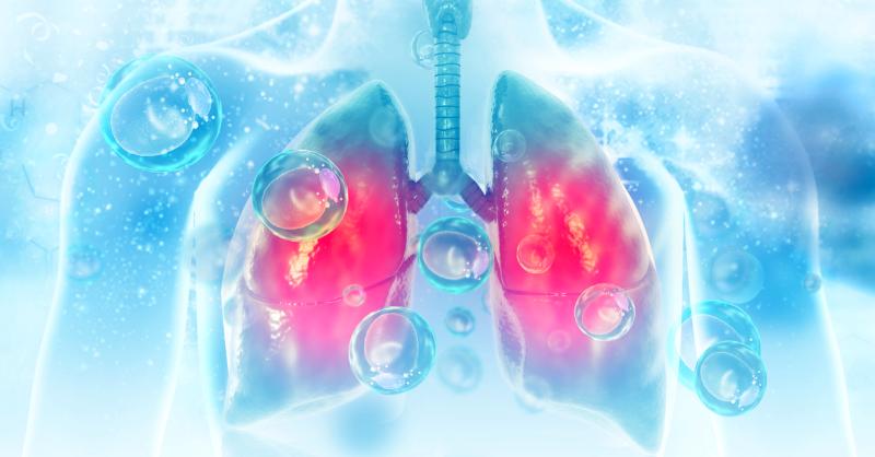 Understanding Honeycomb Lung in Interstitial Lung Diseases | MedSynapse Understanding Honeycomb Lung in Interstitial Lung Diseases | MedSynapse