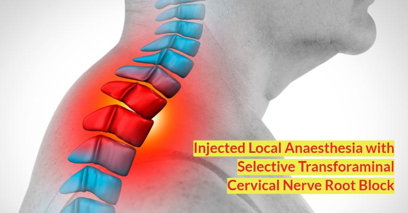 Case of Subdural Spread of Injected Local Anaesthesia in a Patient with ...