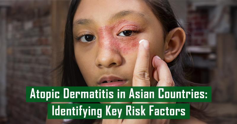 Understanding the Prevalence and Risk Factors of Atopic Dermatitis in ...