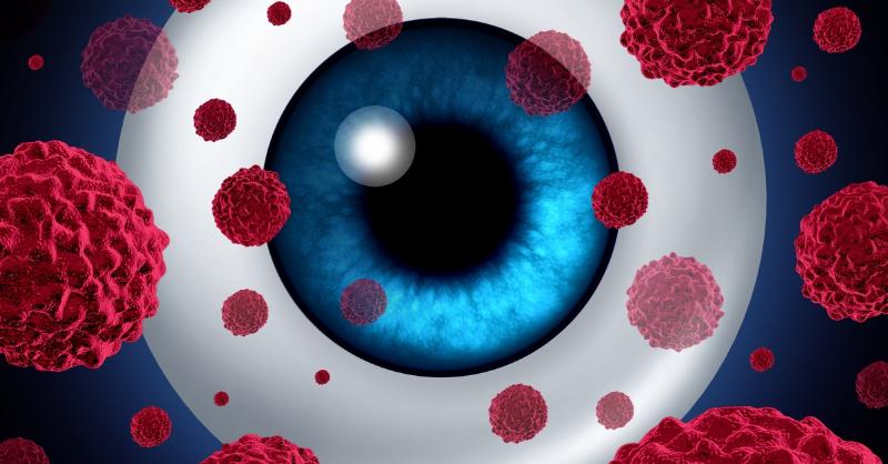Pathophysiology of Retinoblastoma | MedSynapse